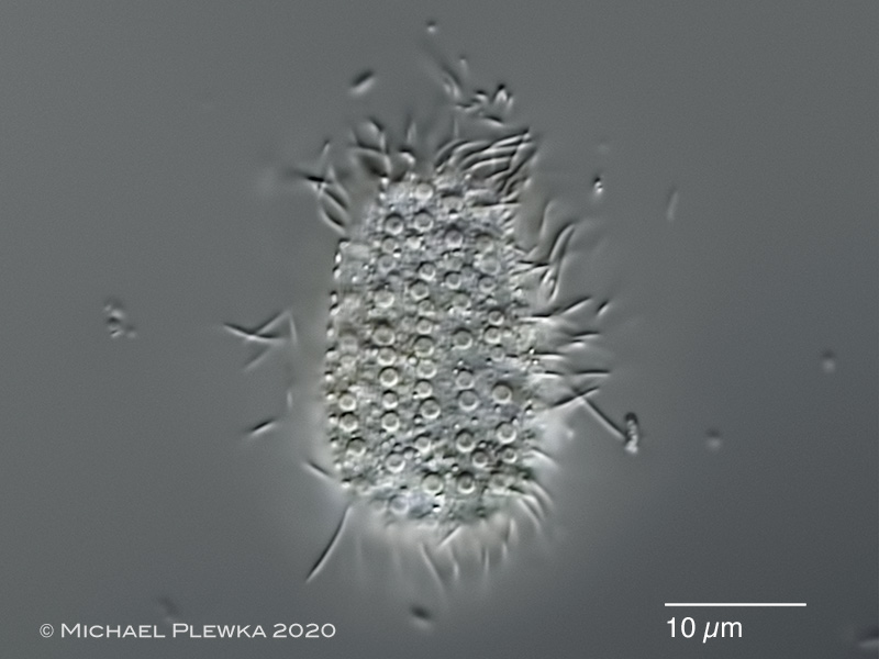 Freshwater and other micro-organisms from Germany: Trithigmostoma ...