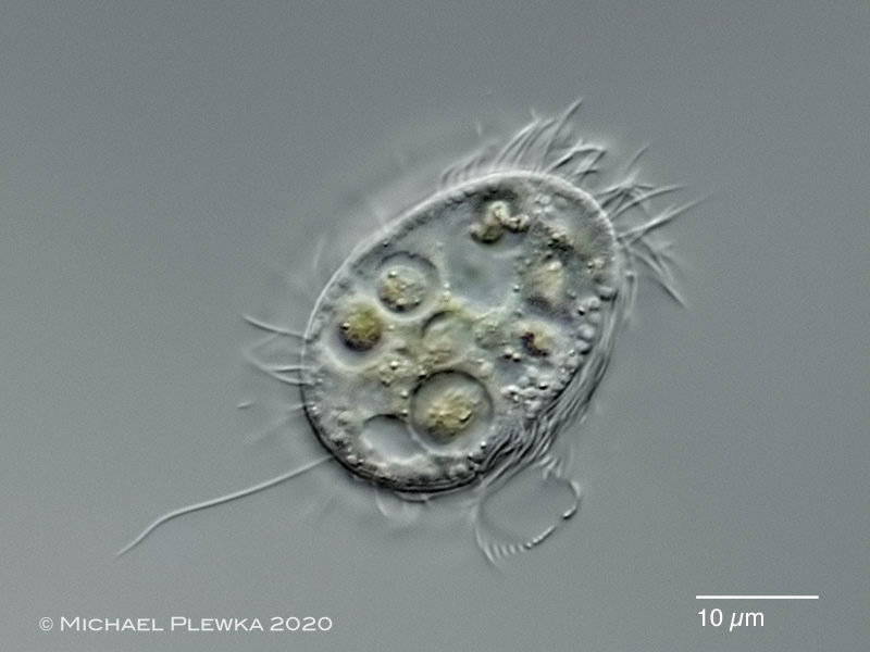 Freshwater and other micro-organisms from Germany: Trithigmostoma ...