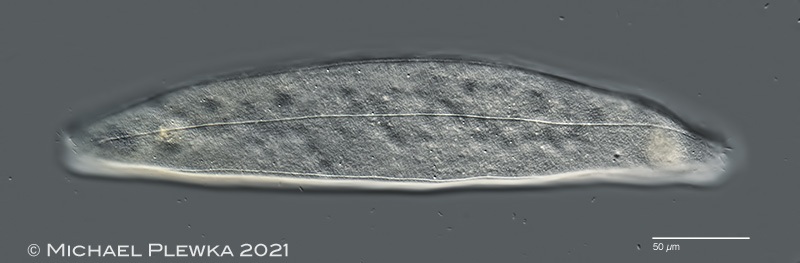 Freshwater and other micro-organisms from Germany: Homalozoon ...