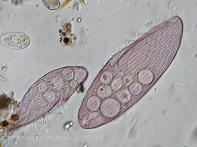 Freshwater and other micro-organisms from Germany: Blepharisma ...